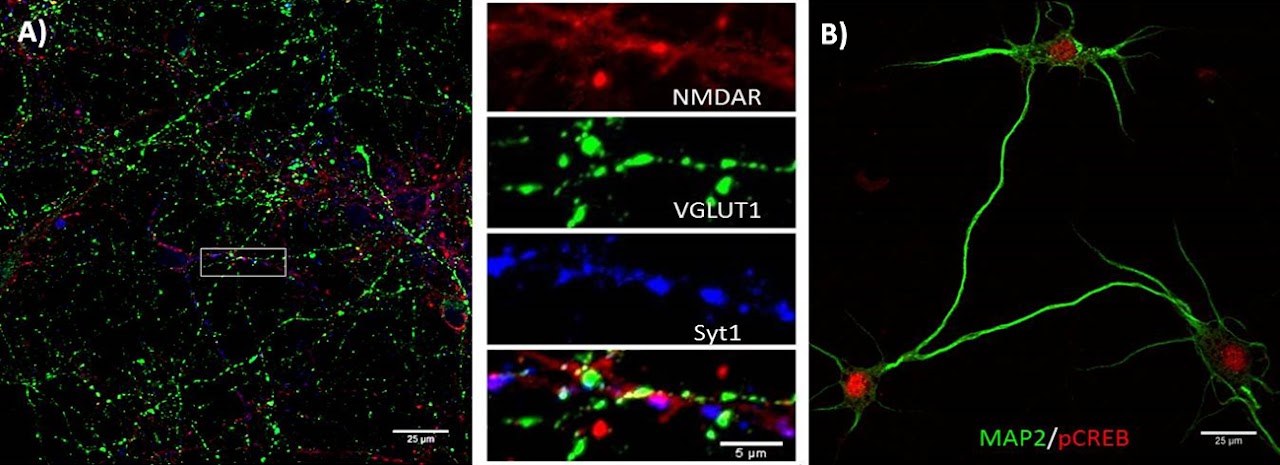 Mechanisms of neuronal plasticity - NeuroScienceLab
