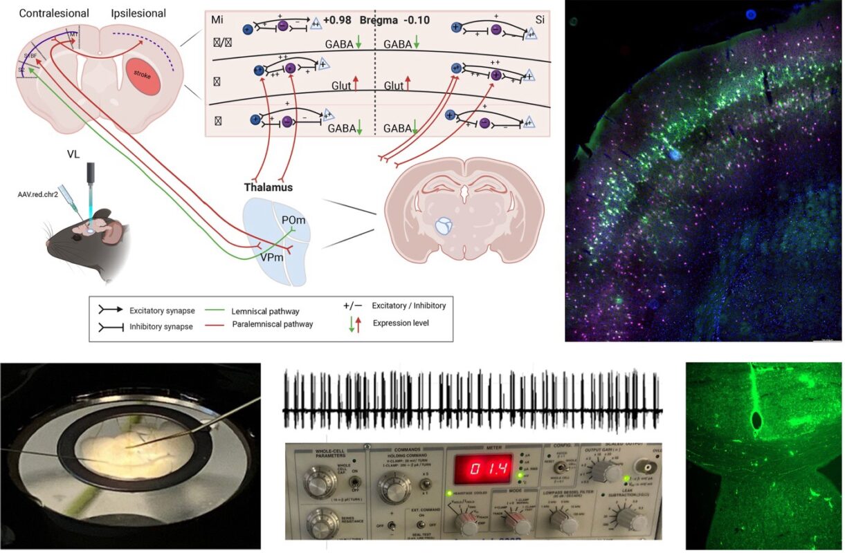 Neuromodulation and Neuroplasticity - NeuroScienceLab